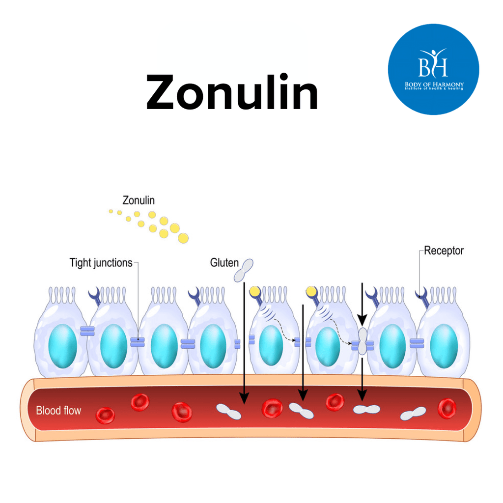 What is Zonulin?
